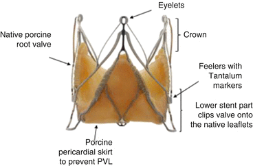 Transcatheter Aortic Valve Implantation: Other Devices | SpringerLink