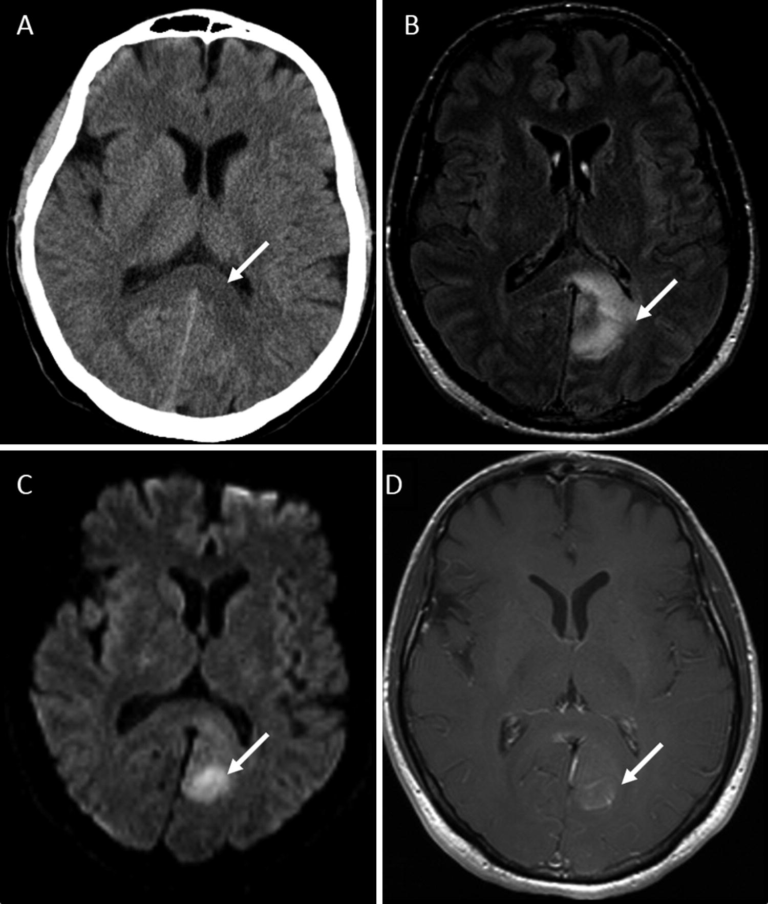 Status Epilepticus | SpringerLink