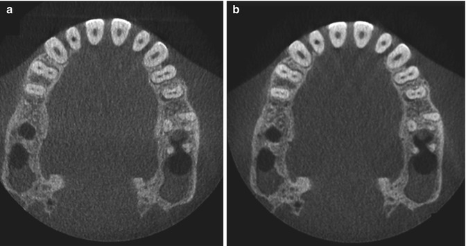 What Is CBCT and How Does It Work? | SpringerLink