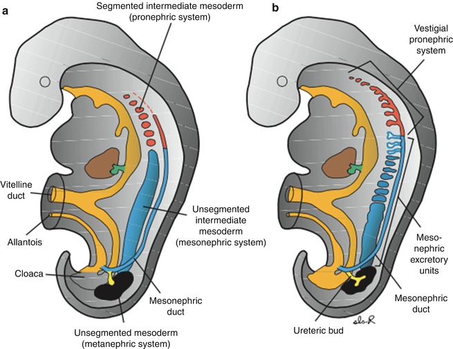 Urachal Anomalies | SpringerLink