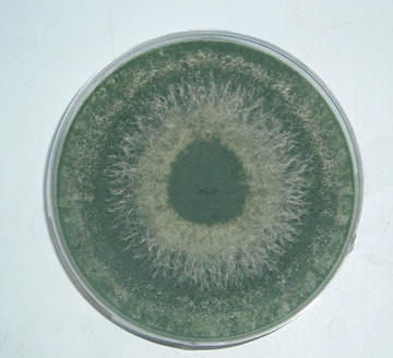 Molecular Characteristics of Trichoderma Strains | SpringerLink