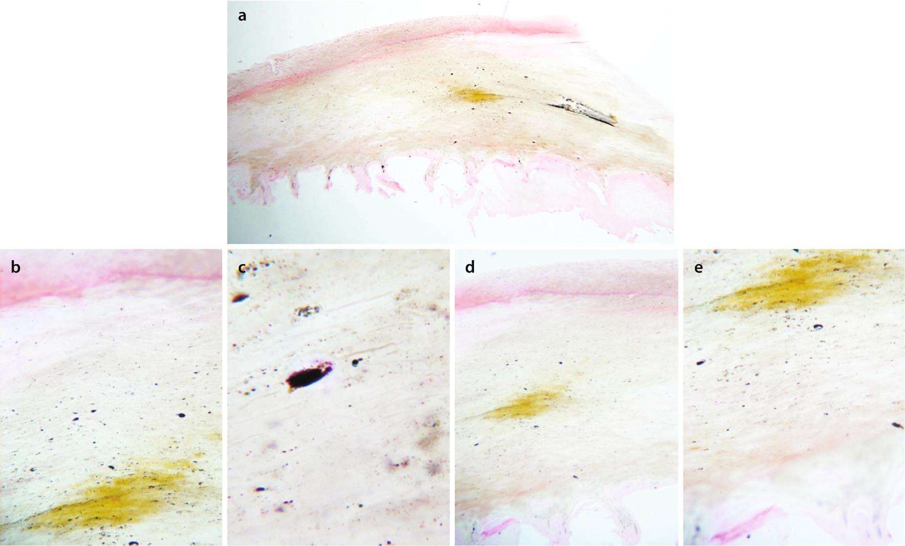 Normal Nail Anatomy, Normal Nail Histology, and Common Reaction ...