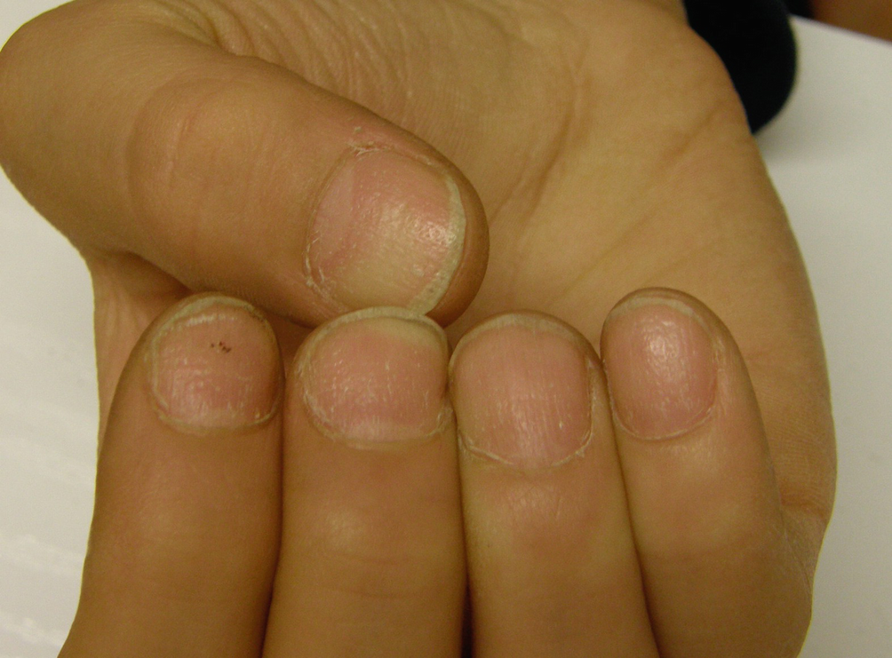 Trachyonychia | SpringerLink