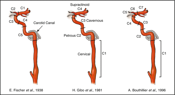 Essential Neurovascular Anatomy | SpringerLink