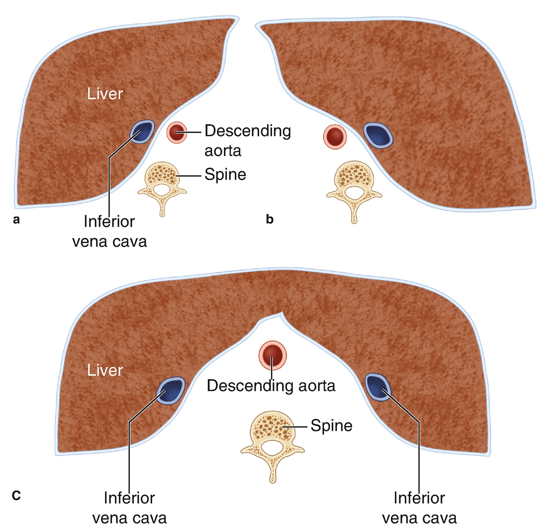 Terminology: Defining Cardiac Position, Chamber Morphology and Van ...