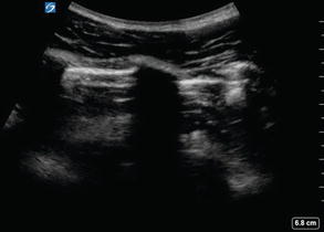 Introduction: Basic Ultrasound Principles | SpringerLink