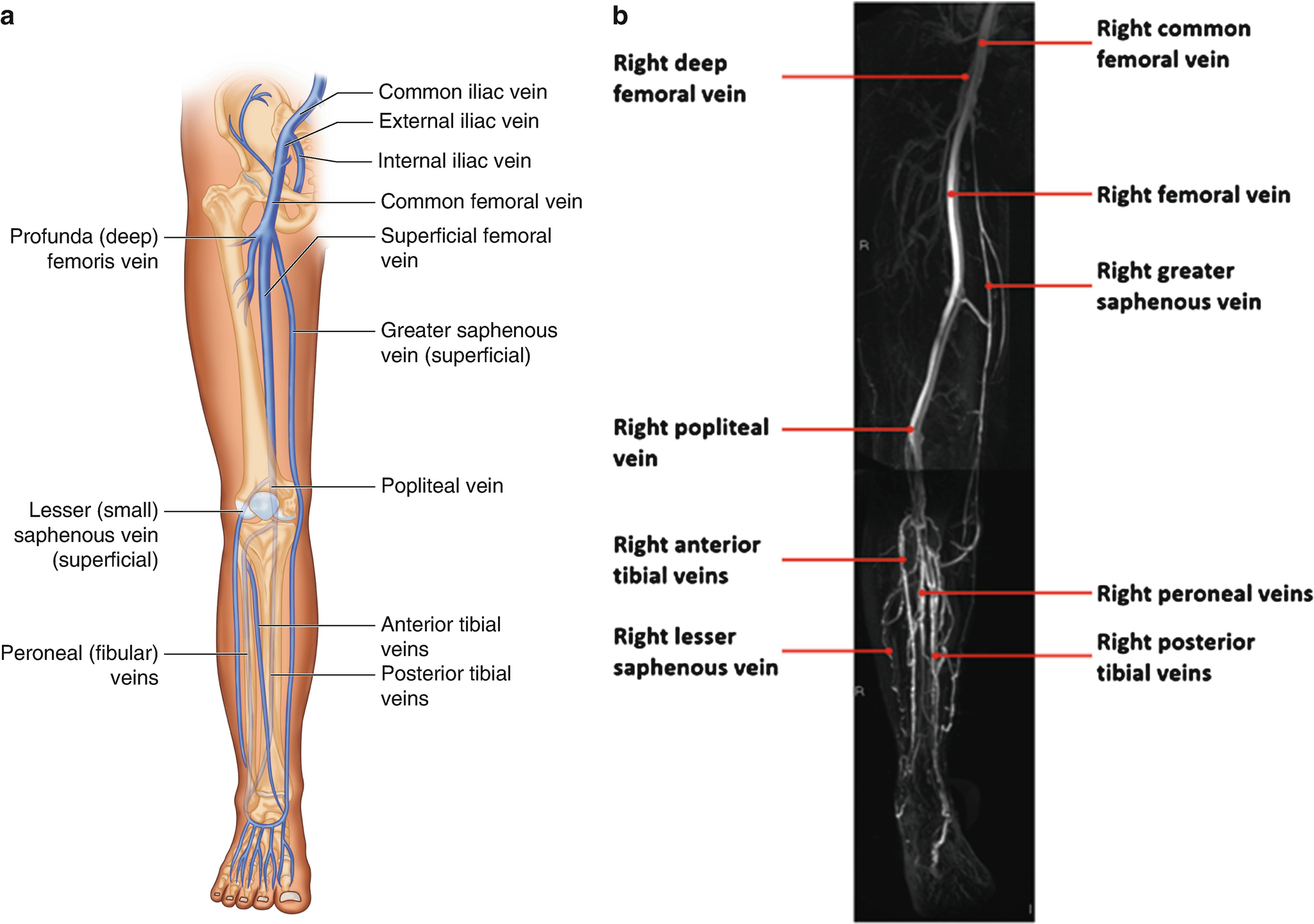 The IR Road Map: Vascular Anatomy Overview | SpringerLink