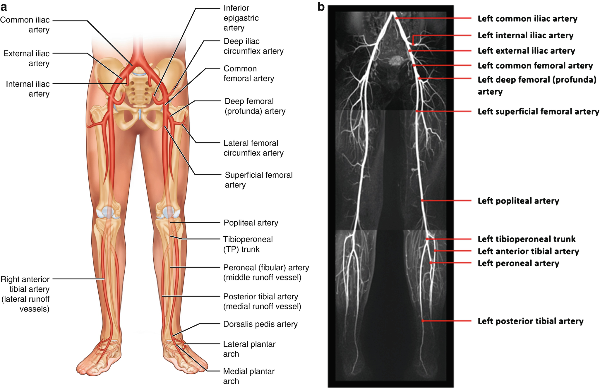 The IR Road Map: Vascular Anatomy Overview | SpringerLink