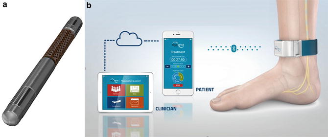 The Future of Neuromodulation | SpringerLink