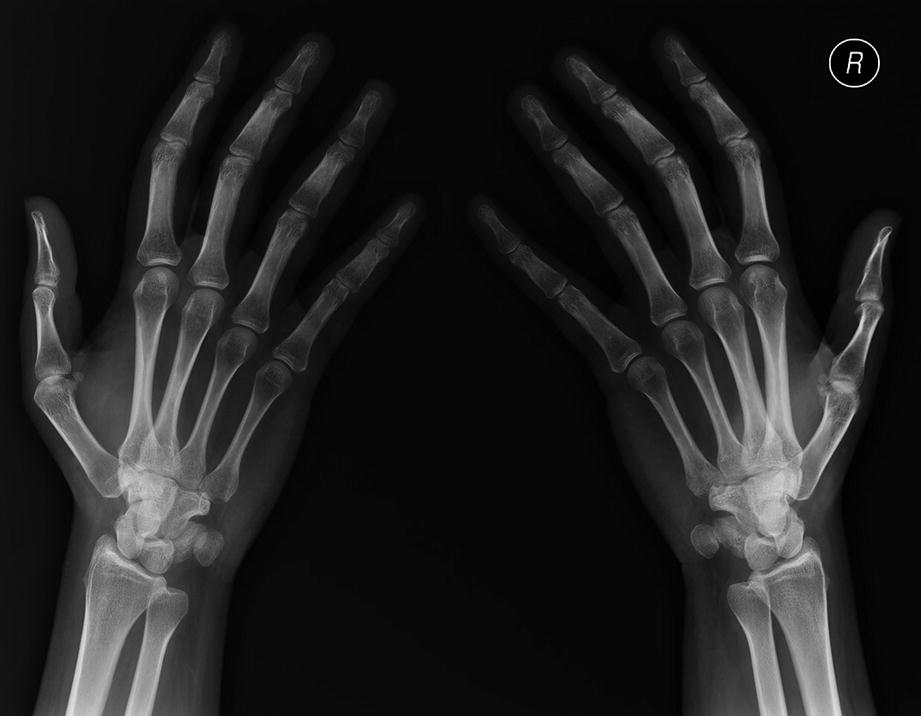 Imaging Anatomy: Conventional Radiography | SpringerLink