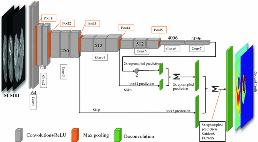MRI Brain Tumor Segmentation and Patient Survival Prediction Using Random Forests and Fully ...