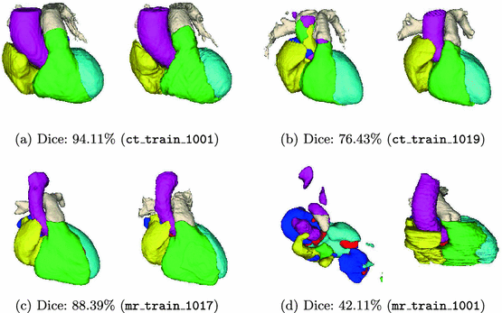 Multi-label Whole Heart Segmentation Using CNNs and Anatomical Label ...