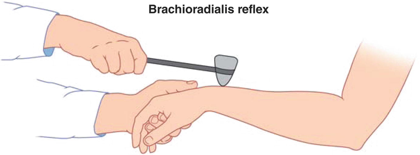 Neurologic Examination | SpringerLink