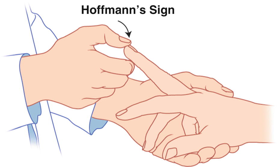 Neurologic Examination | SpringerLink