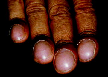 Abnormal Shape | SpringerLink