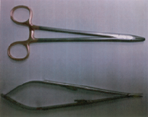 Growth Induction (the Foker Procedure) and a Flexible Approach for the ...