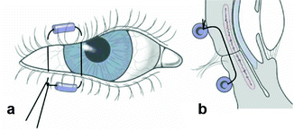 Ocular Surface and Reconstructive Surgery | SpringerLink