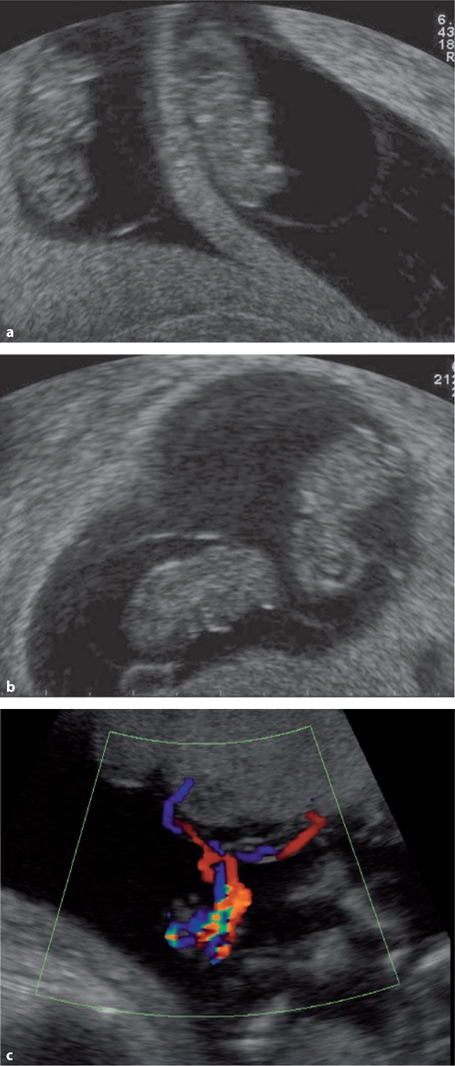 Mehrlinge | SpringerLink