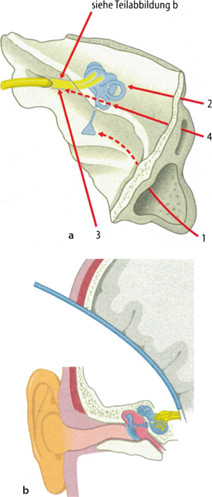 Klinik des Innenohres | SpringerLink