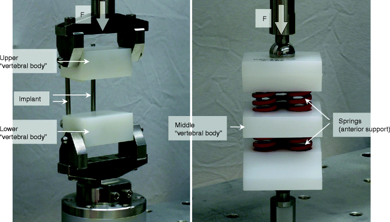 Mechanical and Biomechanical Testing of Spinal Implants | SpringerLink