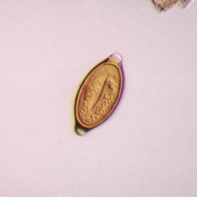 Trichuris | SpringerLink