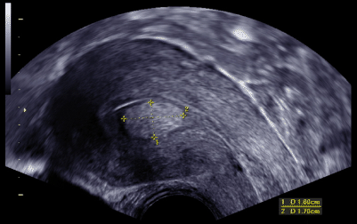 Uterus | SpringerLink