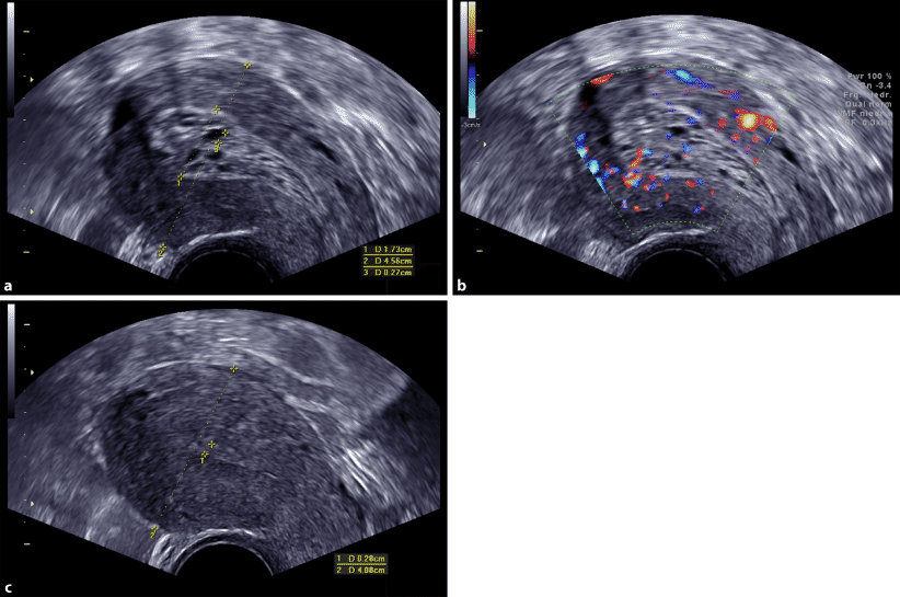 Uterus | SpringerLink