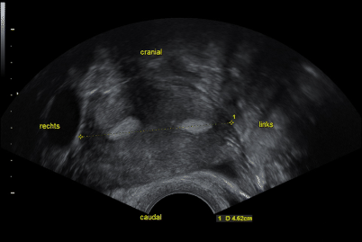 Uterus | SpringerLink