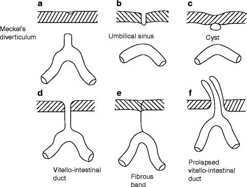 The Umbilicus | SpringerLink