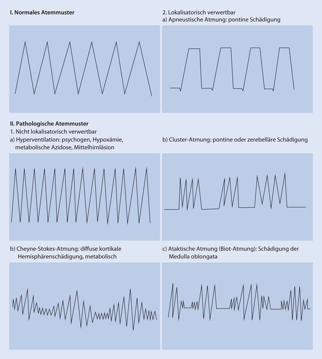 Fallbeispiel Neurochirurgie – Hirndruck | SpringerLink