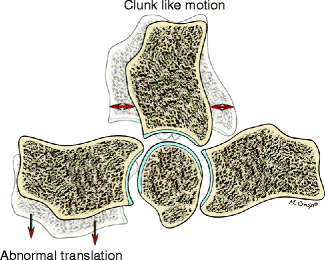 Anatomy and Biomechanics of the Distal Radioulnar Joint (DRUJ ...