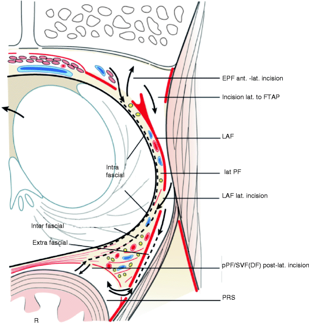 Surgical Anatomy of the Prostate for Radical Prostatectomy | SpringerLink