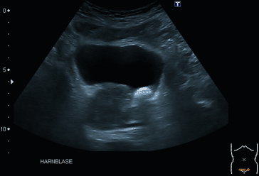 Niere, ableitende Harnwege und Harnblase | SpringerLink