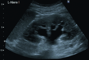 Niere, ableitende Harnwege und Harnblase | SpringerLink