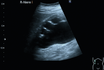 Niere, ableitende Harnwege und Harnblase | SpringerLink