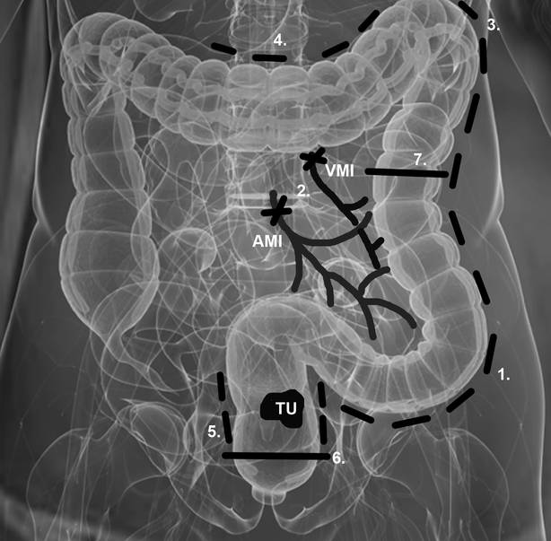 Besonderheiten der laparoskopischen Operation | SpringerLink
