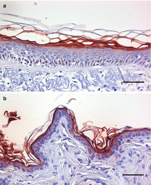 Filaggrin-2 | SpringerLink