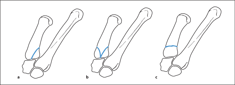 Site Specific Trauma | SpringerLink