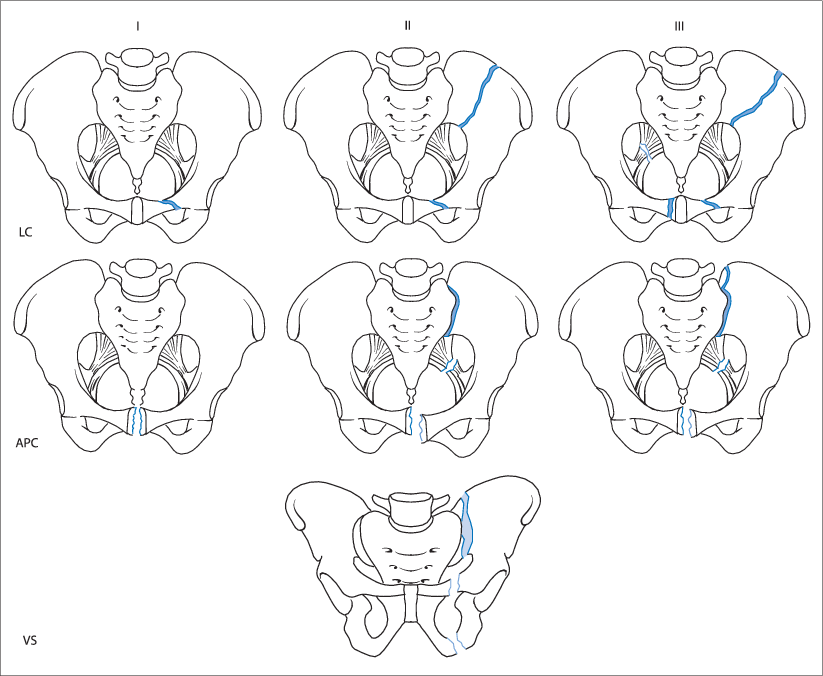 Site Specific Trauma | SpringerLink