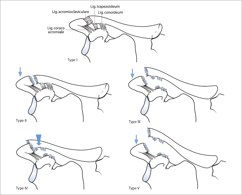 Site Specific Trauma | SpringerLink