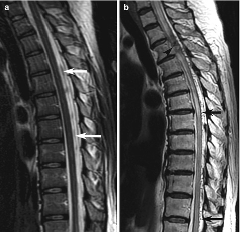 Brain | SpringerLink