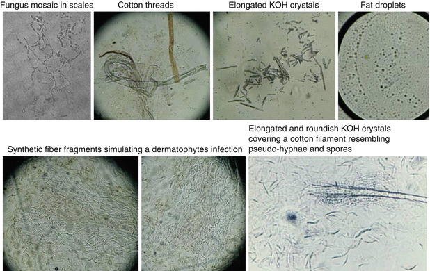Mycological Examination | SpringerLink