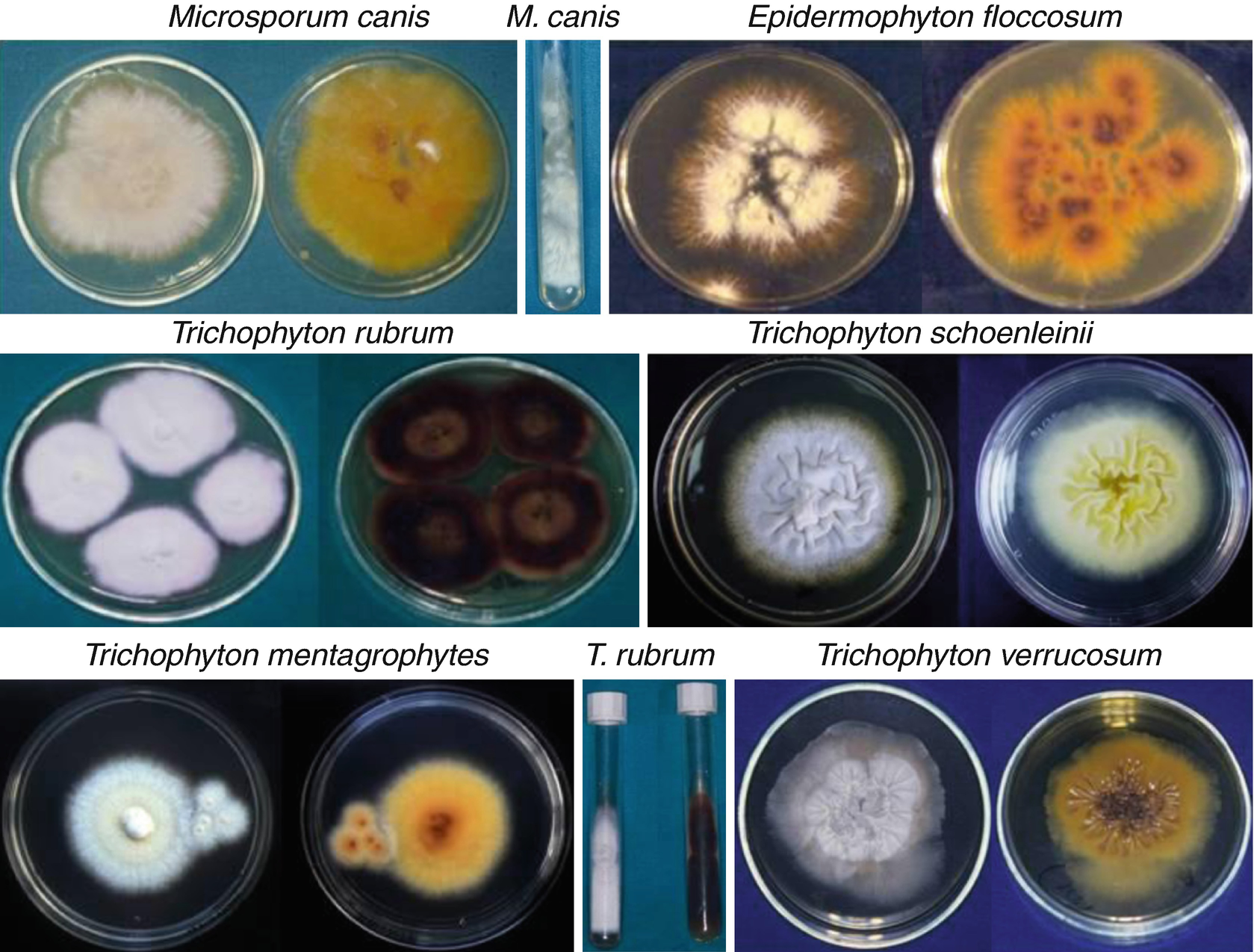 Mycological Examination | SpringerLink