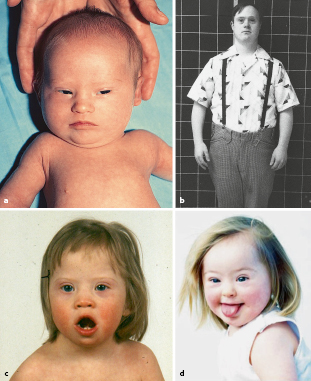 Mutationen | SpringerLink