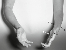 Schädigungen der peripheren Nerven | SpringerLink