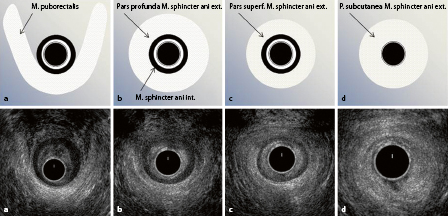 Proktologische Diagnostik: Proktoskopie, Rektoskopie und Endosonografie ...