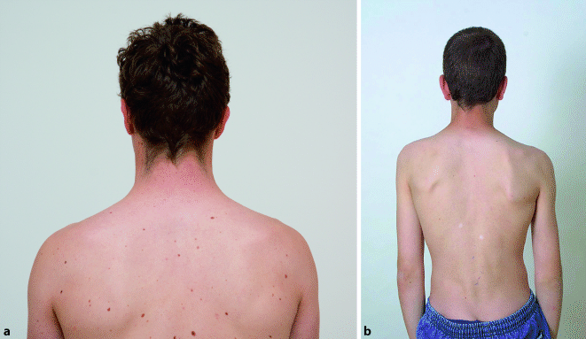 Obere Extremität | SpringerLink