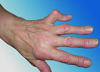 Obere Extremität | SpringerLink