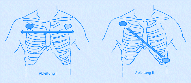 Unterstützung und Förderung der Atmung | SpringerLink