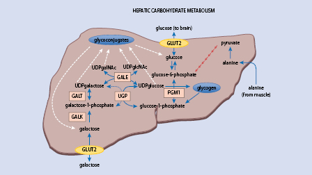 Disorders of Galactose Metabolism | SpringerLink